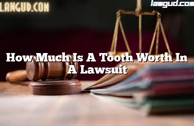 How Much Is A Tooth Worth In A Lawsuit - LawGud